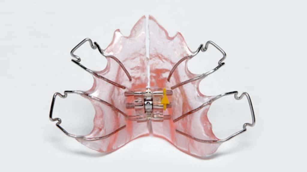 Airway Orthodontics in Bakersfield, CA | Baker Braces